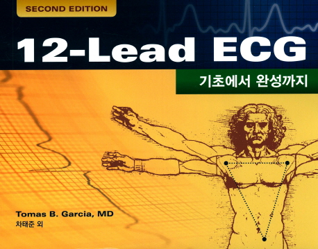 심전도, Left anterior fascicular block (LAFB)과 left posterior fascicular ...
